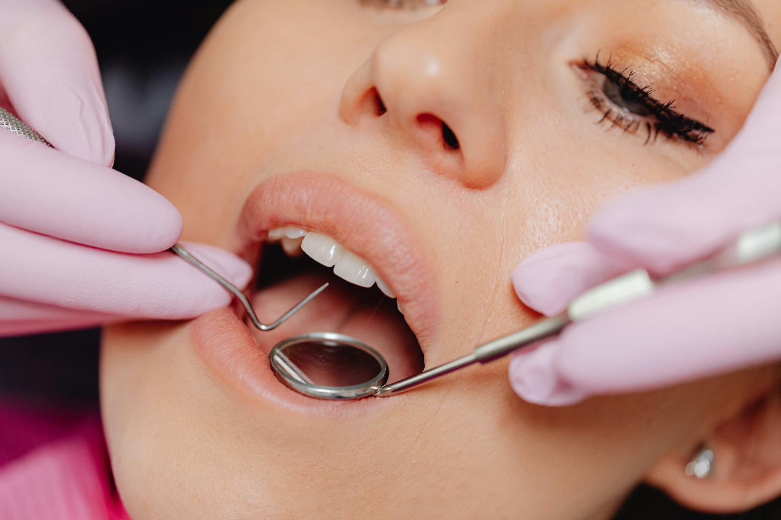 Dental Crowns - American Health Tourism Directory